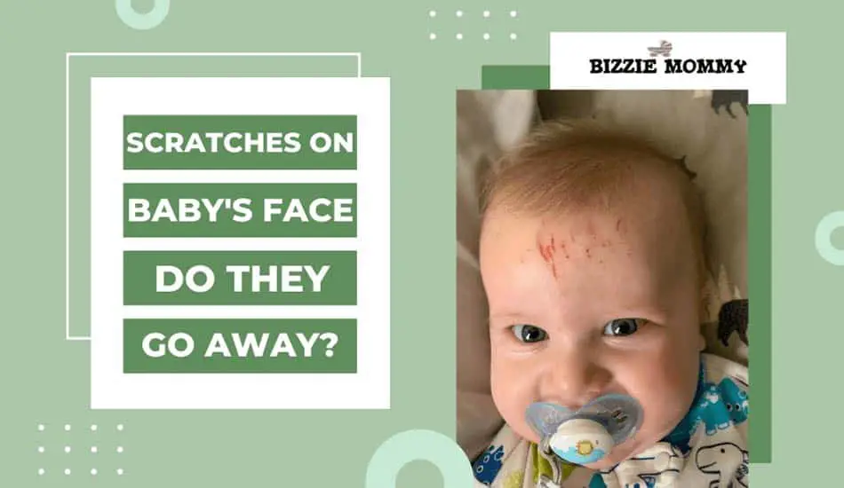 Scratches On Baby’s Face Do They Go Away? - Bizzie Mom